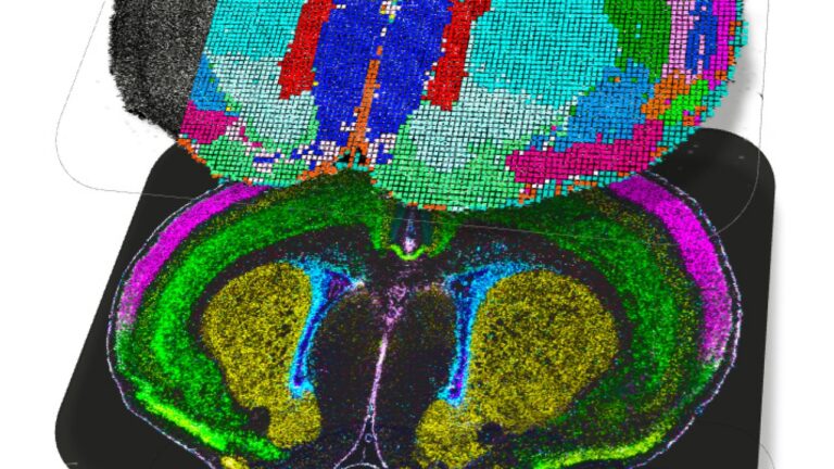 Most complete map of the brain reveals when and how neurons form ...